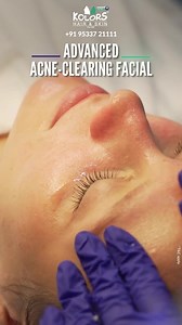 Struggling with acne marks that won’t fade?  At Kolors Hair & Skin, get safe, non-invasive treatments under the care of certified skin experts. ✨ Backed by advanced technology & expert supervision. ✨ Get up to 40% OFF – Limited Period Offer! ⌛ Book your consultation now and rediscover clear, confident skin. 殺朗 | Kolors Hair and Skin | Facebook