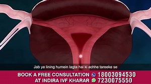 How long does an IVF cycle actually take? If you're considering IVF, knowing the timeline is crucial! Dr. Itisha from Indira IVF Kharar explains the entire process, from the first consultation to embryo transfer. Watch now to get a clear idea of what to expect! Book a free consultation: 18003094530 #IndiraIVF #UnexplainedInfertility #IVFTreatment #ICSIProcedure #FertilitySolutions #HopeForParenthood #FertilityTreatment #ParenthoodDreams #CompleteYourFamily #FreeConsultation #FertilitySpecialists