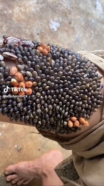 Dealing with Tick Infestation on Human Skin