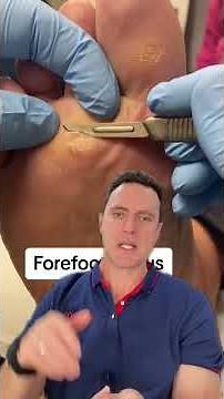 Say Goodbye to Calluses: Podiatrist's Guide to Easy Removal #FootCare #PodiatryTips