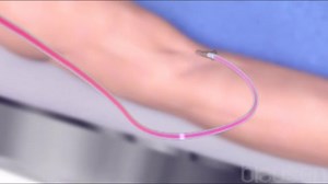 Cathéter veineux central et cathéter veineux périphérique