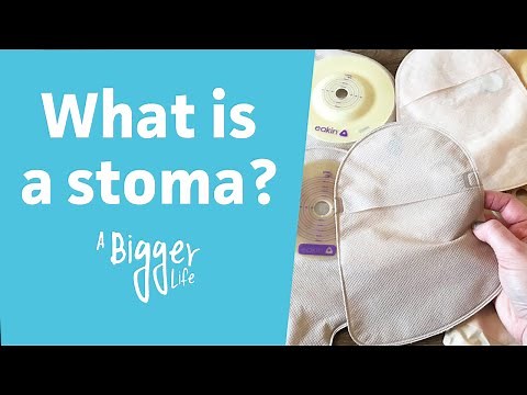 What is a stoma? | The ABC of ostomy
