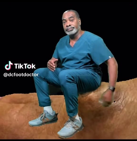 Severe Arthritis of the Big Toe Joint #podiatry #footcare #arthritis #bigtoejoint