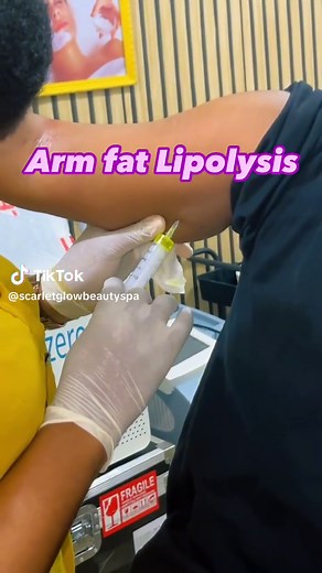 Stubborn arm fat dissolve via Lipolysis Our fat dissolve injections break Those unwanted fat cells to define and contour the body ! You can get yours done with us today Send a dm