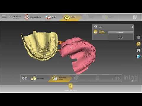 LMT Lab Day Online inLab SW 20.0 Overview Demo