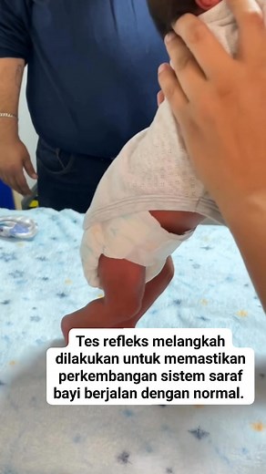 The doctor will check the baby's reflexes to ensure that the baby's nervous system is developing normally. #babybirth #prematurebaby #nicubaby #cutebaby ‎#lievebaby #babylove ‎#schattigebaby #nicuwarrior ‎#vroeggeborenkind #babyborn ‎#Lenouveaune ‎ ‎ | Yuli Ismalia