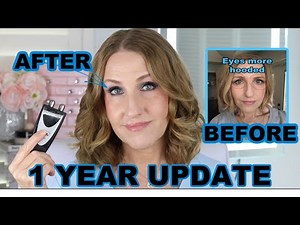 ONE YEAR UPDATE USING THE CLAREBLEND MINI MICROCURRENT