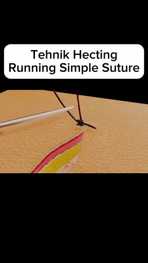 Simple Suture Technique Explained for Beginners