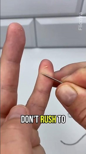 Easy Splinter Removal Hack