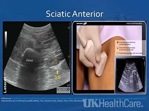 Lower Extremity Peripheral Nerve Blocks - Dr. Ferrell