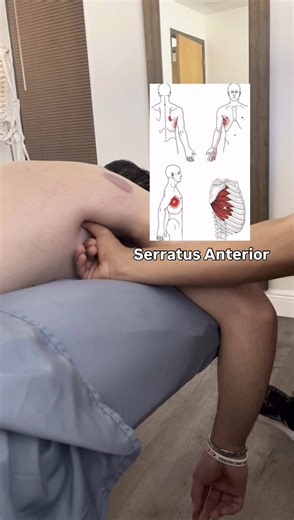 Unlocking Shoulder Stability with Serratus Anterior Exercises