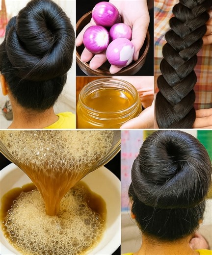 "How to make onion hair oil for faster hair growth and stop hair fall Must express something to keep getting my recipes.... Thank you😍" | Health Tips Tricks