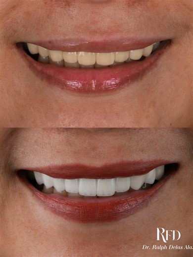 Transform Your Smile at Urban Smiles Dental Clinic