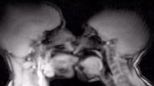 One detail leaves scientists baffled after couple had sex in MRI scan machine