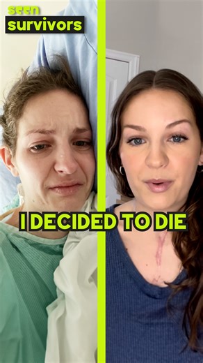 566K views · 12K reactions | I Should Be Dead ‘I made the decision to end my life because I couldn’t bear another surgery.’ Lauren faced septic shock following spinal surgery, resulting in a persistent infection resistant to multiple treatments. In a twist of fate, opting for end-of-life care ultimately saved her. She shares her incredible story of resilience and hope. | seen.tv | Facebook