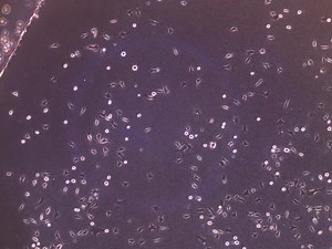 File:Living-biointerfaces-based-on-non-pathogenic-bacteria-support-stem-cell-differentiation-srep21809-s3.ogv - Wikimedia Commons