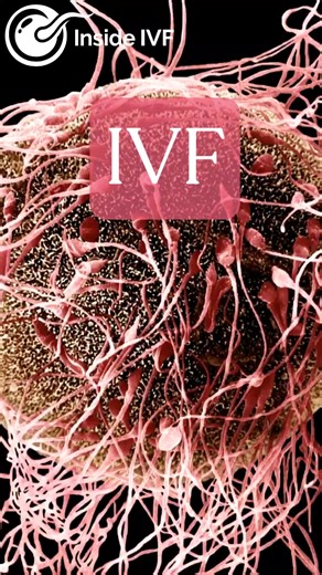 This is a real capture of the exact moment of fertilization ✨ Not only has IVF helped us learn so much about how life begins, but it's helped more than 13 million people have babies who wouldn't have been able to without it 💕 #IVF #TTC #ivfjourney #baby #ivfsuccess