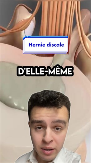 La chiropratique peut vous aider à attenuer les symptômes d’une hernie discale. #herniediscale