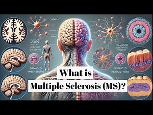 What is Multiple Sclerosis (MS)? | Healthcare and Medicine