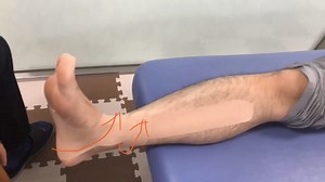 簡単に巻ける！シンスプリントのキネシオテーピング、セルフチェック付き | 筑紫野市二日市の杏鍼灸整骨院