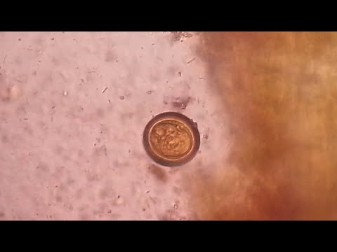 Egg of tapeworm or Taenia under the Microscope of saline preparation