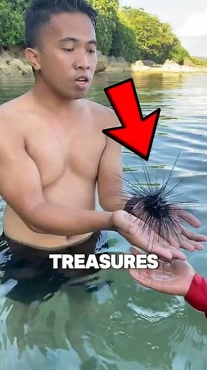 Sea Urchin Shells Under the Microscope! 😱