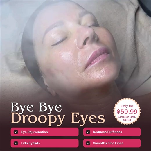 ❤ 𝗡𝗢𝗪 𝗔𝗩𝗔𝗜𝗟𝗔𝗕𝗟𝗘 𝗜𝗡 𝐏𝐋𝐀𝐍𝐓𝐀𝐓𝐈𝐎𝐍, 𝐅𝐋 ❤ Try it THIS MONTH ONLY for $59.99 (Valued at $249.99) 📍 LOCATION: 201 N University Drive, Suite 114, Plantation, FL 33324 ✨ Try Your Bye Bye Droopy Eye Treatment! ✨ Specialized treatment targeting droopy eyelids and under-eye concerns. Rejuvenate your eye area for a more alert, youthful appearance. 👉 Book now: https://skinpluscare.com/skyn-med-spa/droopy-eye/evergreen ✔ Lifts droopy eyelids naturally ✔ Reduces under-eye puffiness & 