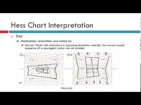 Hess Chart Interpretation