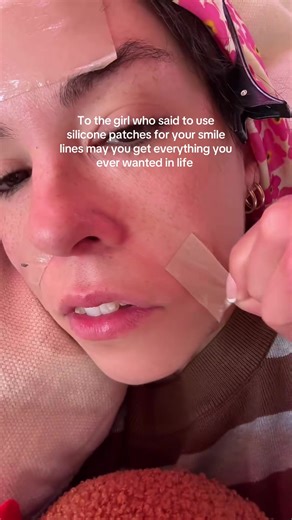 Silicone scar sheets #siliconescartape #siliconescarsheets #acnescar #acnemarks #skincaretips