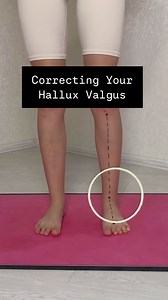 1.3M views · 14K reactions | Send this to anyone with flat feet! 禮 It’s time to fix it! After all, foot deformity = body deformity! Reduce swelling, fatigue, and pain in your legs and knees! 例 Repost @ #workout #feet #foundation #footexercises #gym #exercises #workout #uk #usa #canada #pt #trainer #legstretching #glutes #gym #weights #gymexercises | Alex.Germany.Chiropractor | Facebook