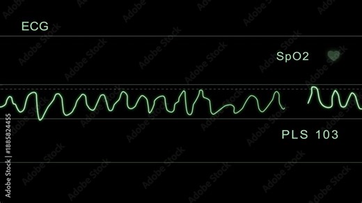 Pulse display device used at the healthcare center SpO2 HUD ECG looping Heart rate Ventricular fibrillation.Abnormal heart rhythm.Cardiogram monitor.Technological HUD for medicine and science 4k video