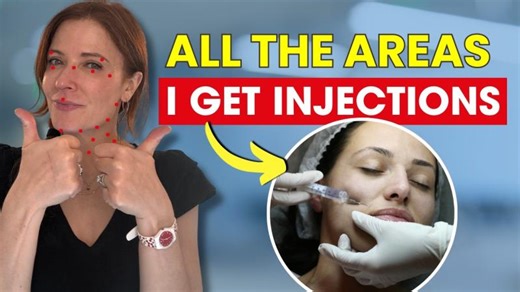 Exactly Where I Get My Injections and Why | Botox Filler Placement | Dr. Mary Alice Mina | Mary Alice Mina