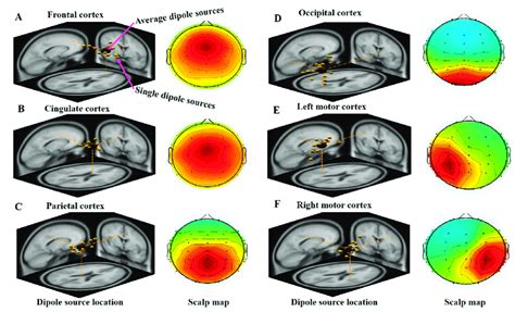 eeg dipole source location and scalp map of six clusters including a download scientific