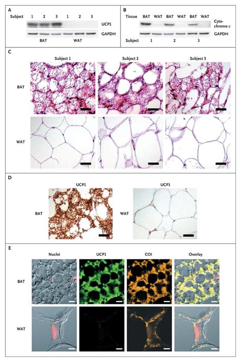 Functional Brown Adipose Tissue In Healthy Adults Nejm