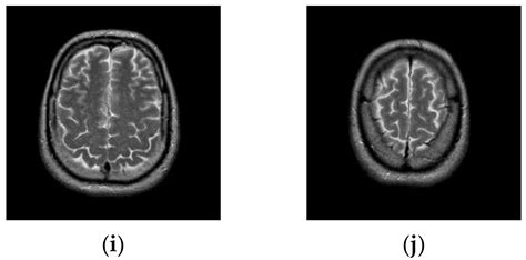 entropy free full text an interval iteration based multilevel thresholding algorithm for