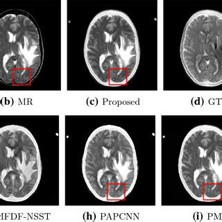Comparison Of Fusion Results By Different Methods A B The Input CT