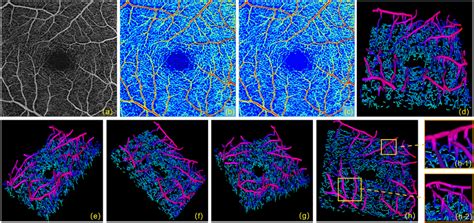 illustration of depth map and 3d vessel reconstruction a en face download scientific diagram
