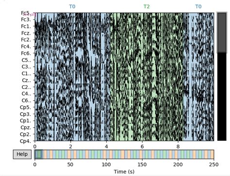 raw eeg signals for motor execution class for left and right hand movements download