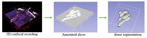 【论文】3d u net learning dense volumetric segmentation from sparse annotation volumetric images csdn博客
