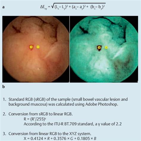 colorimetric evaluation of conventional capsule endoscopy ce images download scientific