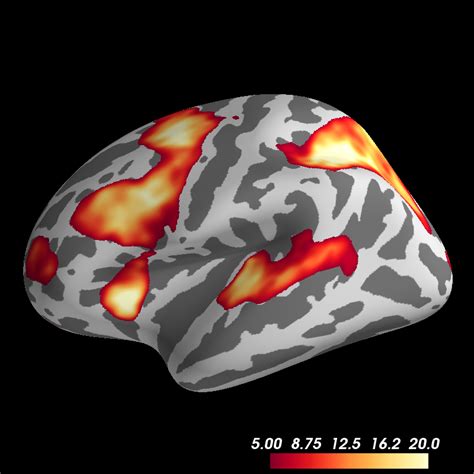 pysurfer python neuroimaging visualization — pysurfer 0 10 0 documentation