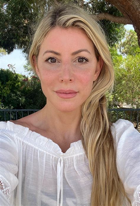 I Tried Profhilo Injections And My Skin Has Never Looked Better — See Photos Allure
