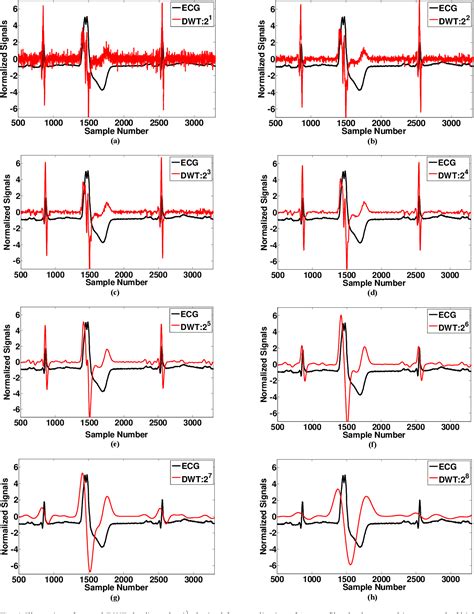 figure 2 from detection and classification of heart premature contractions via α level binary