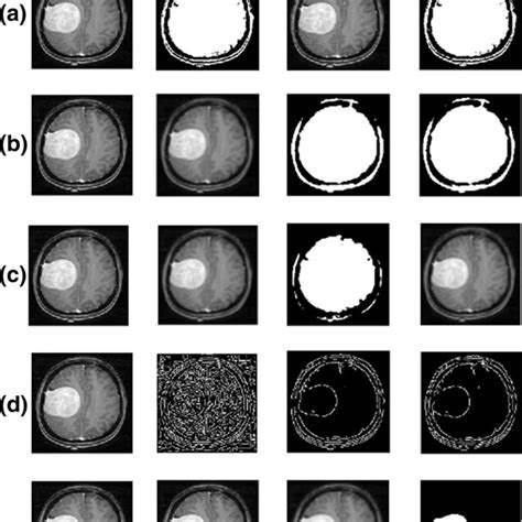 the proposed system model for brain tumor detection using mr image download scientific diagram