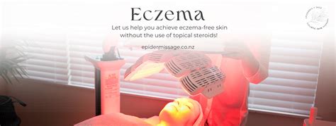 Eczema Skin Treatment Epidermis Sage Holistic Skincare Therapists