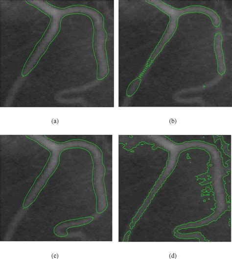 segmentation results a improved active contour method b local download scientific diagram
