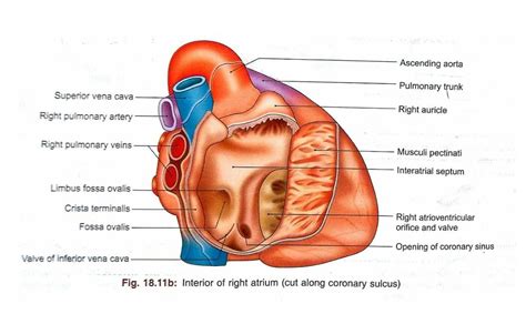 Right Atrium Imedscholar
