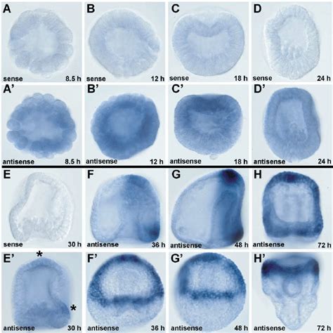 Spatial Expression Patterns Of Sphnf6 MRNA At Different Time Points In
