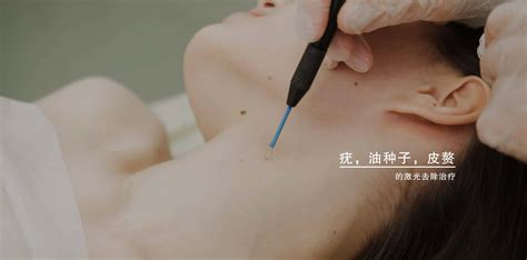 疣油种子皮赘的激光去除治疗 Ensoul Medical Clinic