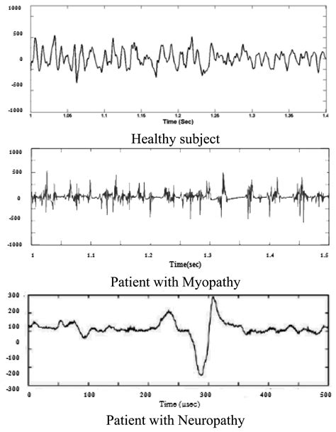 sensors free full text surface electromyography signal processing and classification techniques
